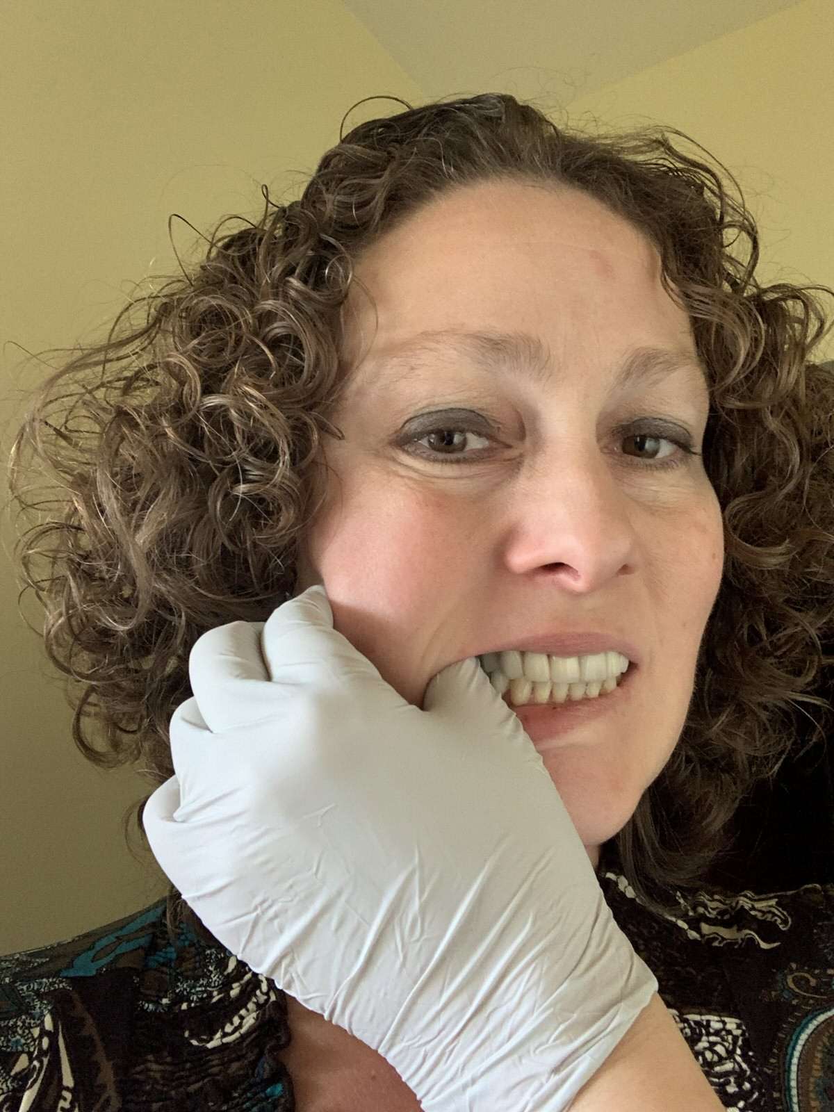 Tmj Self Massage The Masseter Restorative Health And Wellness